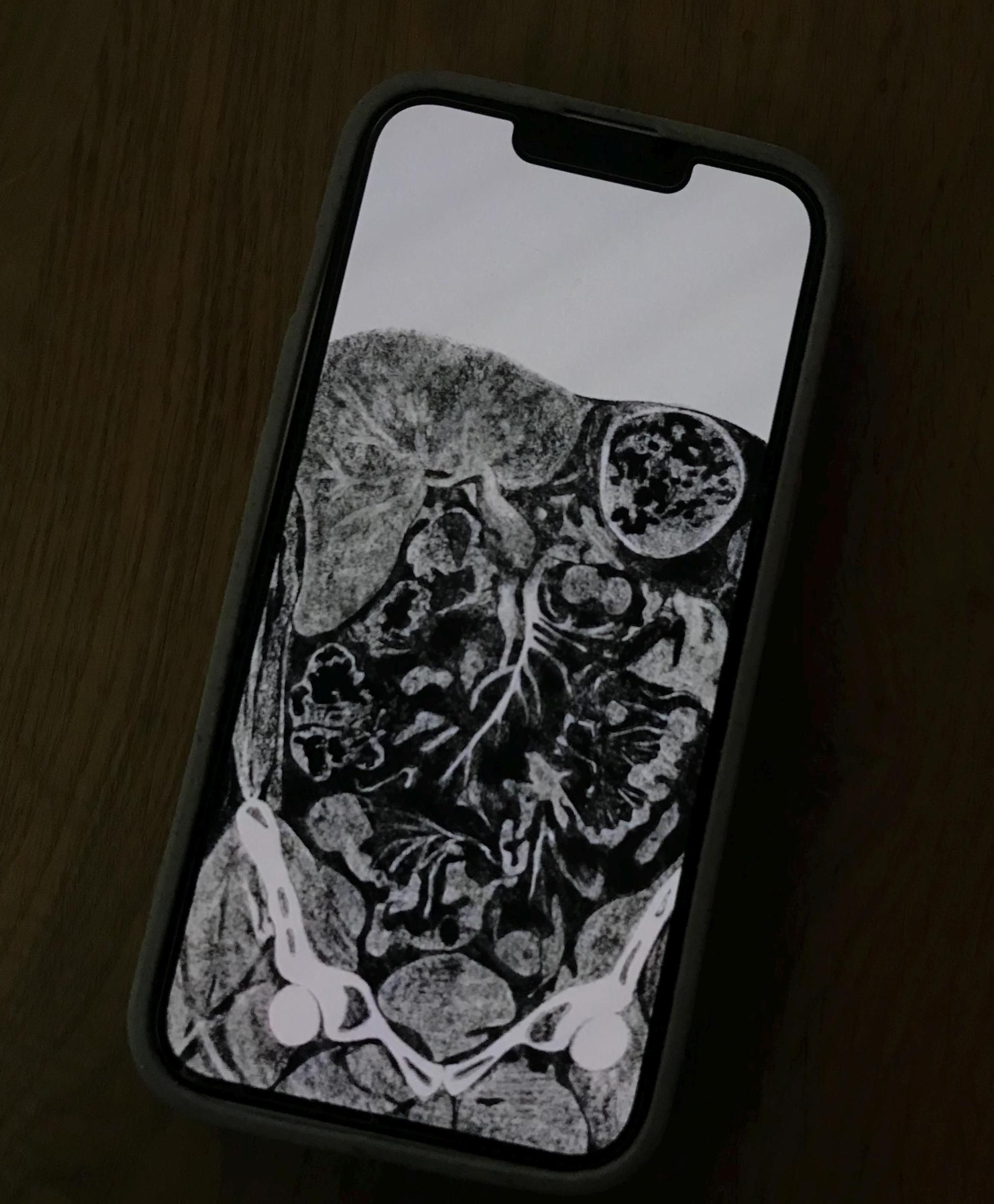 Regular iPhone Wallpaper of CT Scan of Abdomen - Medical Art iPhone ...