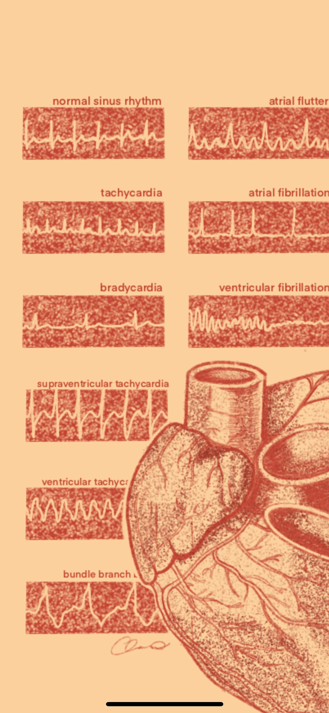 Cardiology/heart Anatomy iPhone Wallpaper & Background (ORANGE/BEIGE ...