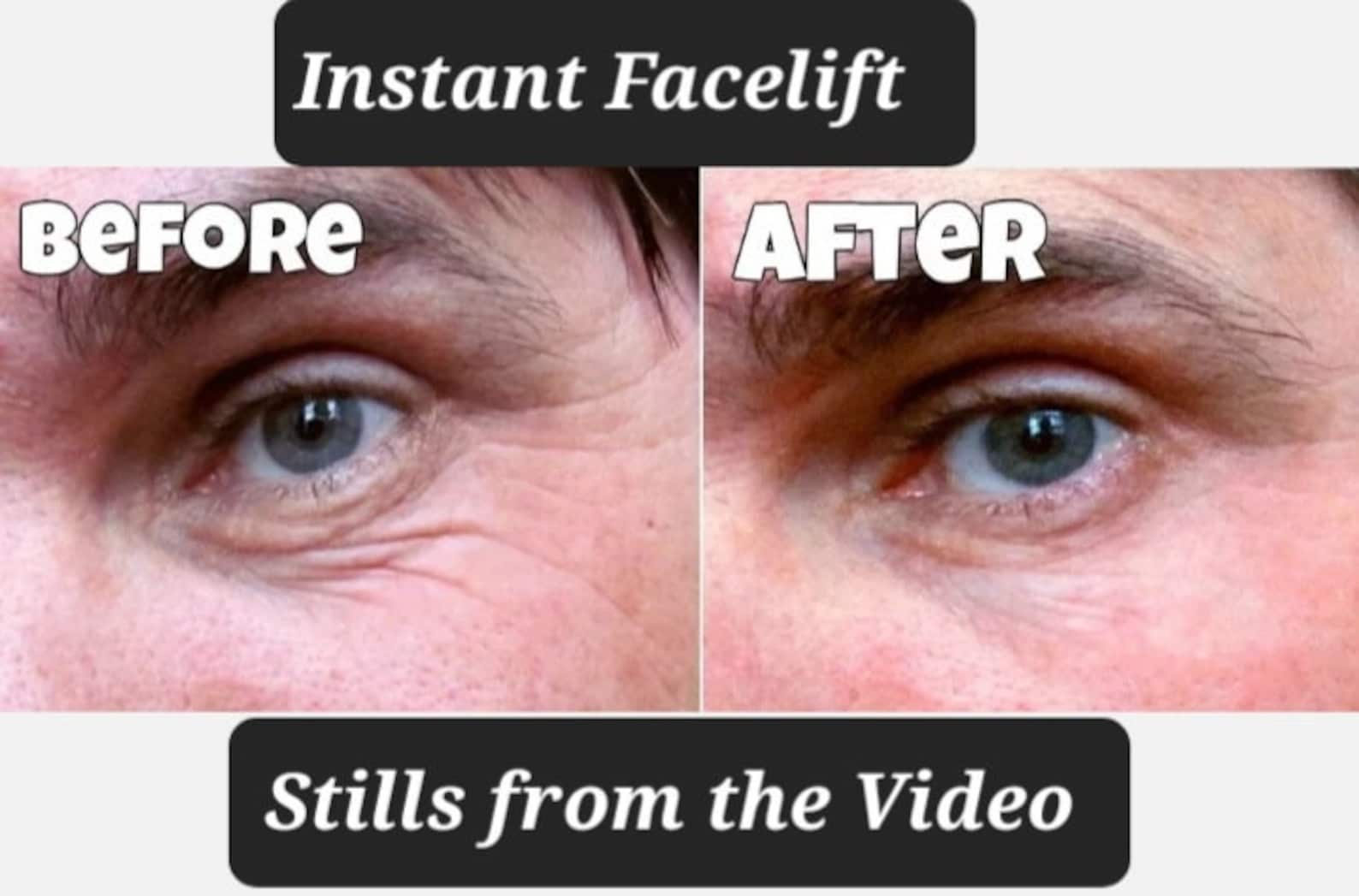 BOTOX ALTERNATIVE Miracle One 1 Minute Instant Facelift Wrinkle Remover ...