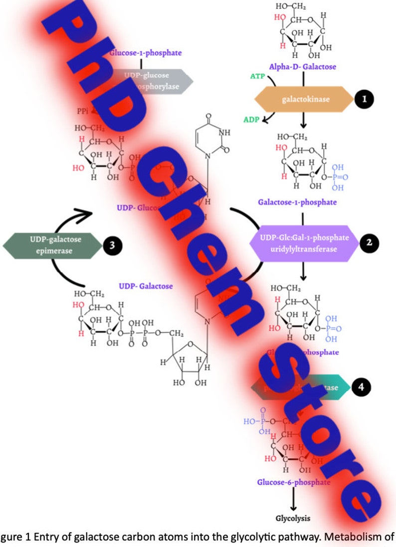 Biochemistry: Galactose Metabolism and Disorders - Study Notes - Etsy