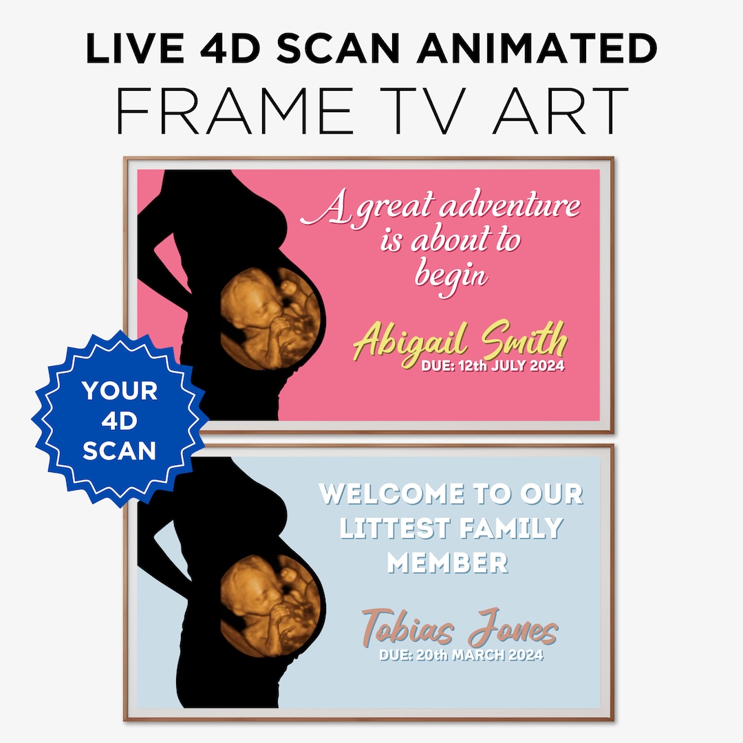 Personalized Live 4D Pregnancy Scan Animated Samsung Frame TV Art ...