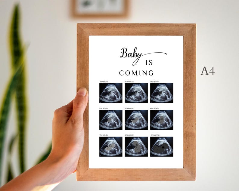 Baby Shower Sonogram Ultrasound Art for New Baby, Womb Development ...