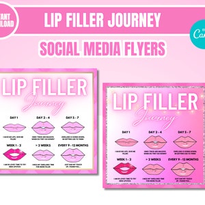Lip Filler Journey Flyer, Lip Injections Templates, Lip Fillers, Nurse ...