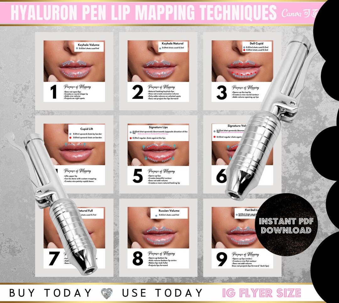Hyaluron Pen Lip Maps, Lip Mapping Guides, Techniques, Russian Lips ...