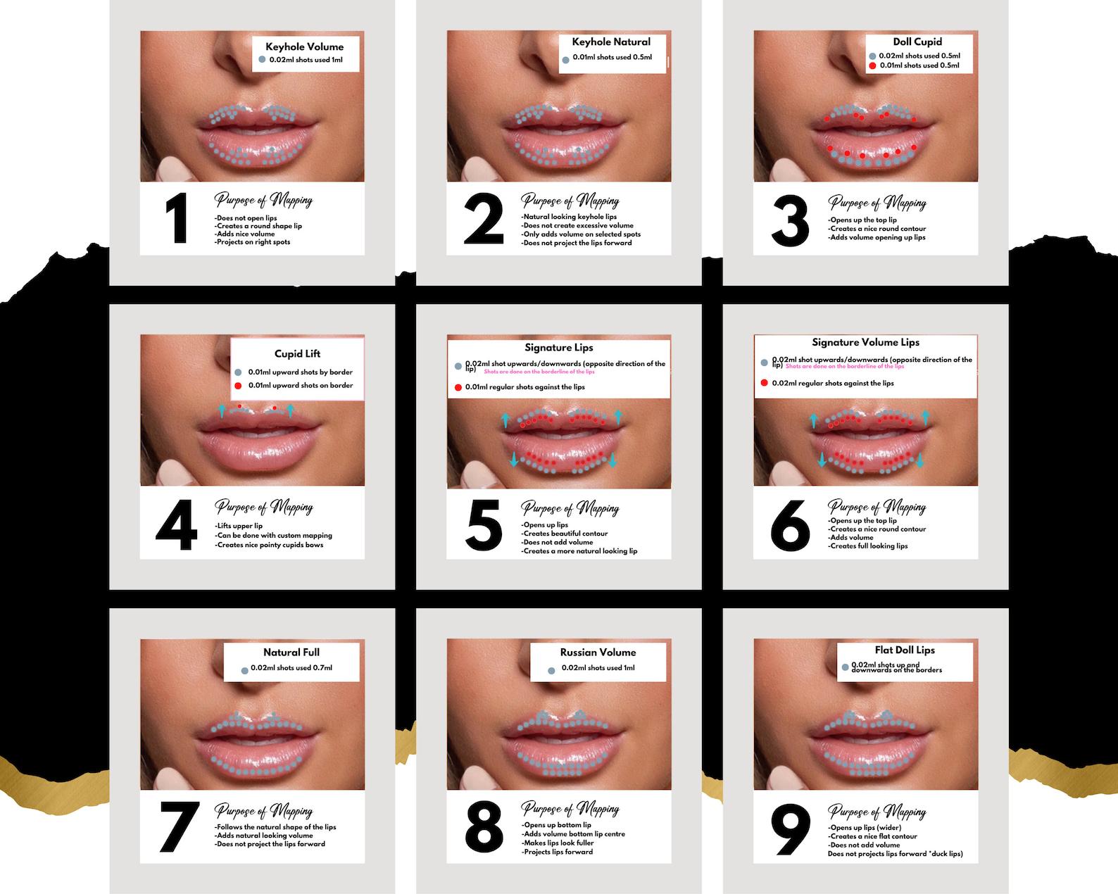 Hyaluron Pen Lip Maps, Lip Mapping Guides, Techniques, Russian Lips ...