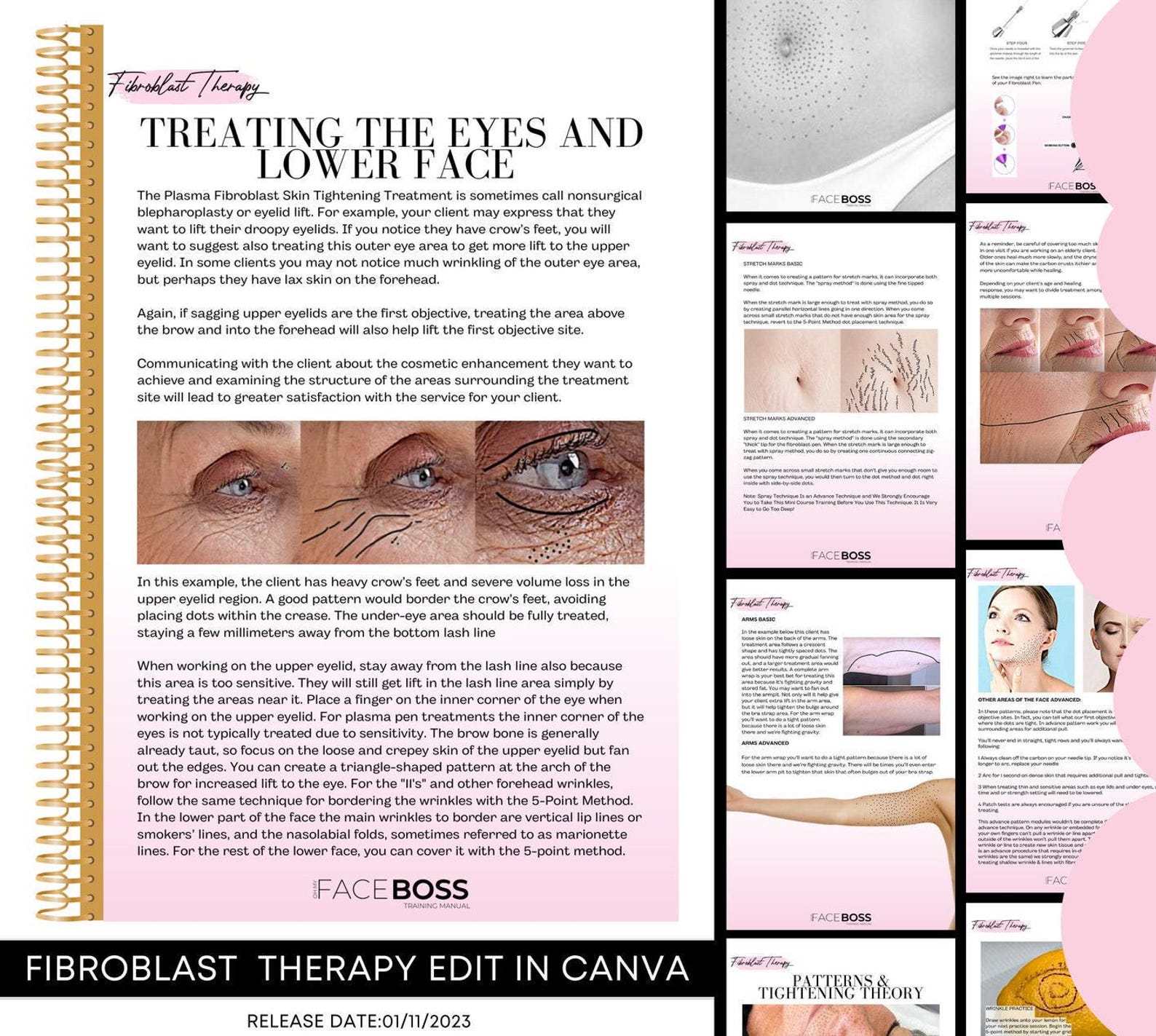 Fibroblast Manual, Plasma Pen Training Guide, Face, Body, Editable ...