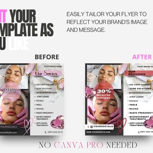 Facial Specials Flyer, VALENTINES Facial Flyer, Facial Treatment Flyer ...