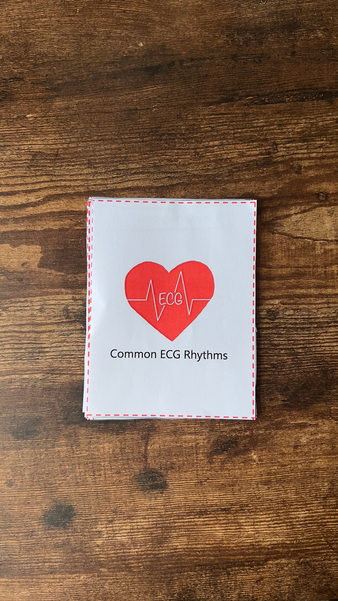 Common ECG Rhythms/ Refresher/ Notes DIGITAL - Etsy