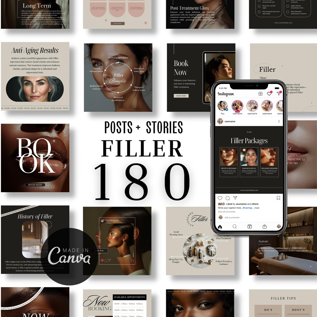 Filler Instagram Templates – 180 Canva Posts & Stories for Injectors ...