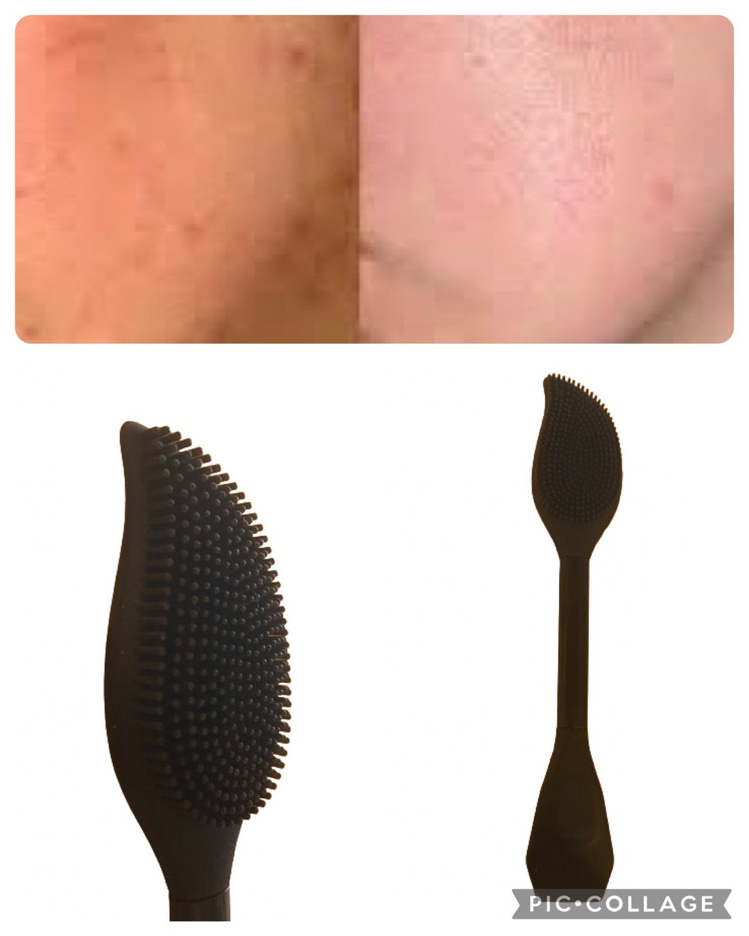 Exfoliate Your Skin With Our Silicon Exfoliator Brush - Etsy