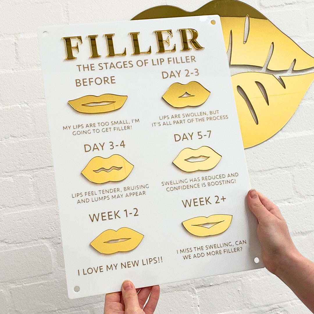 Lip Filler Journey 3D Acrylic Sign | Aesthetics Display Signage ...