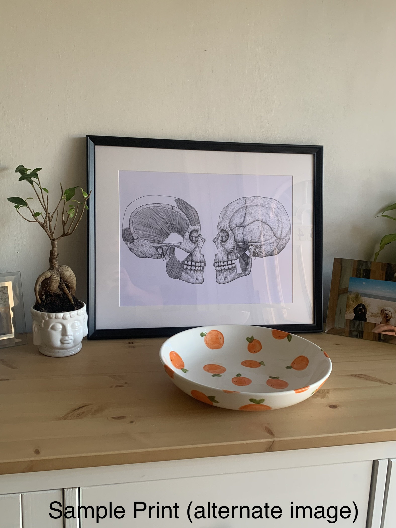 Muscular Layers of the Plantar Foot Human Anatomy Prints Clinically ...