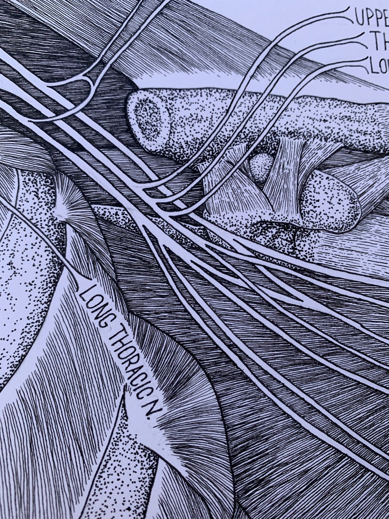 Brachial Plexus Anatomy Poster Print | Clinic Decor Wall Hangings ...