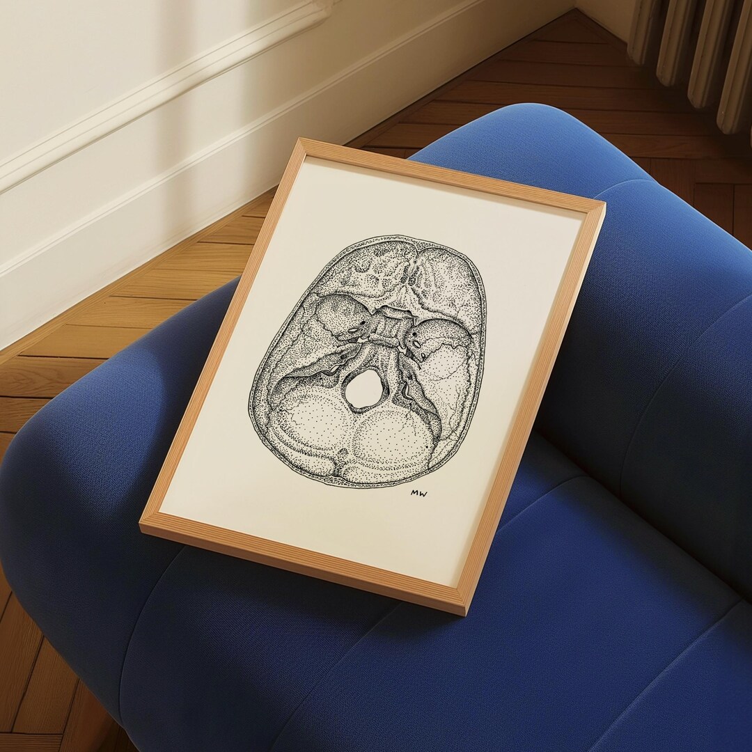 Cranial Foramina Anatomy Poster Print | Clinic Decor Wall Hangings ...