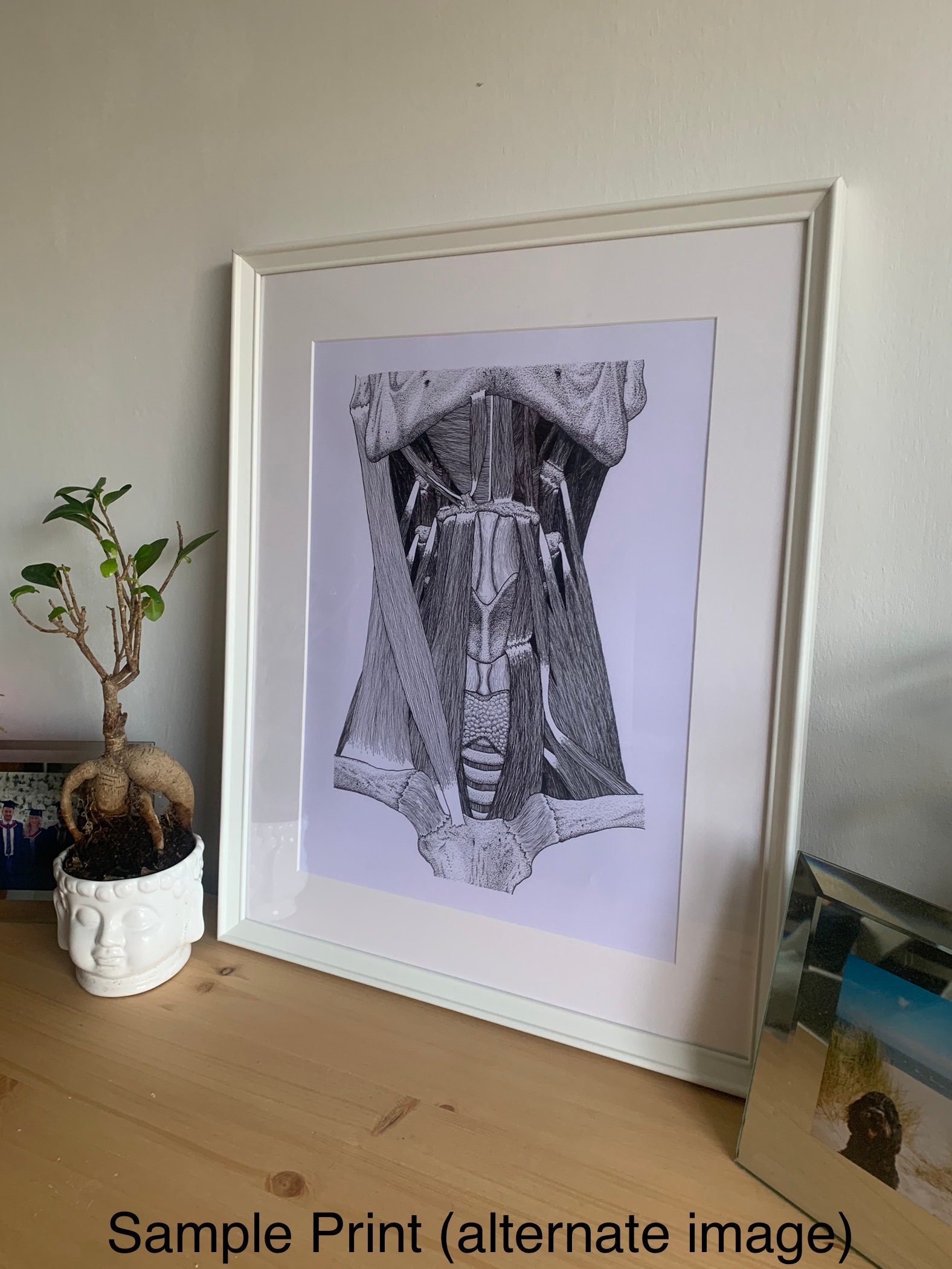 Muscular Layers of the Plantar Foot Human Anatomy Prints Clinically ...