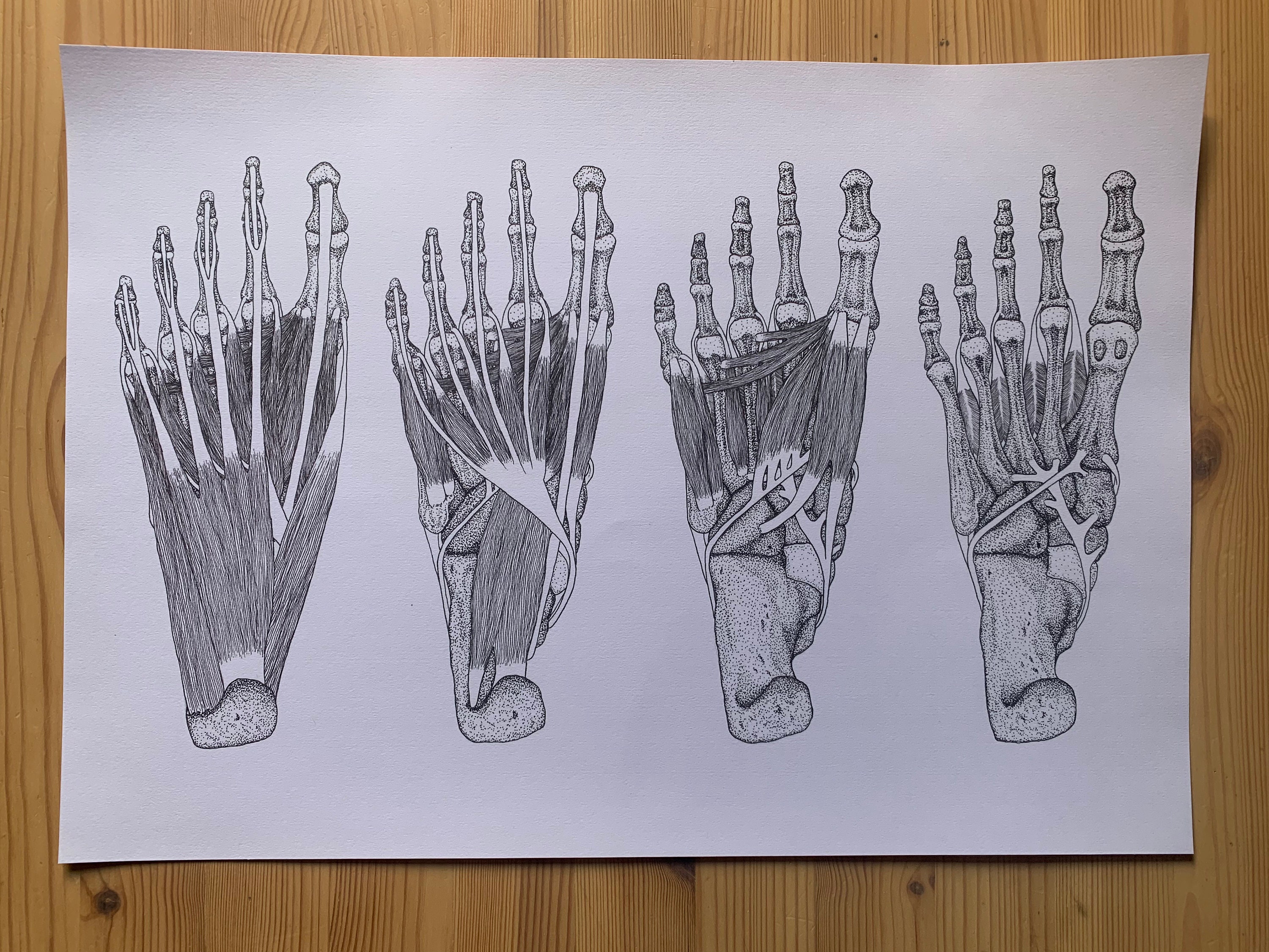 Muscular Layers of the Plantar Foot Human Anatomy Print Clinical ...