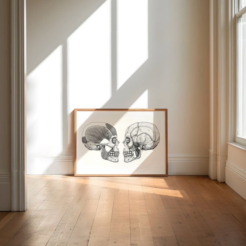 TMJ Anatomy Poster | Hand-drawn Temporomandibular Joint Art for ...
