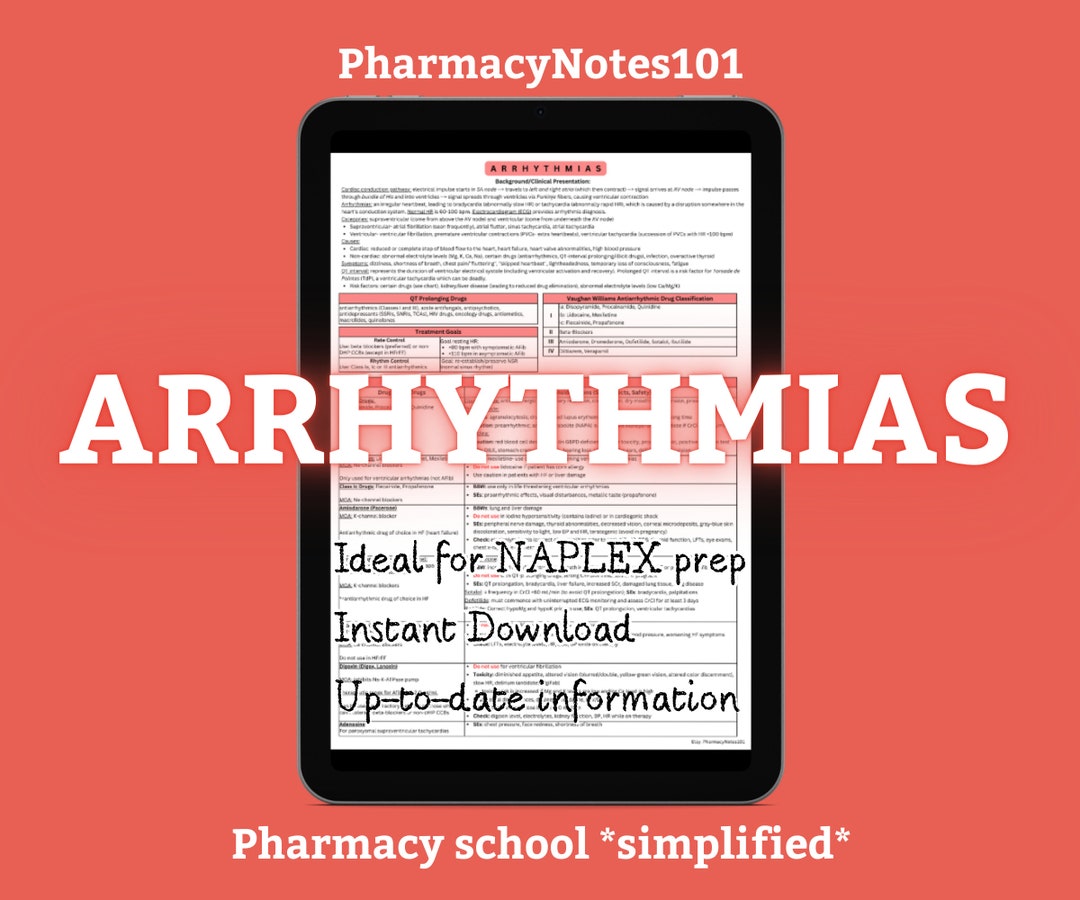 Arrhythmias Study Guide, NAPLEX, Pharmacy School Notes, Pharmacy ...