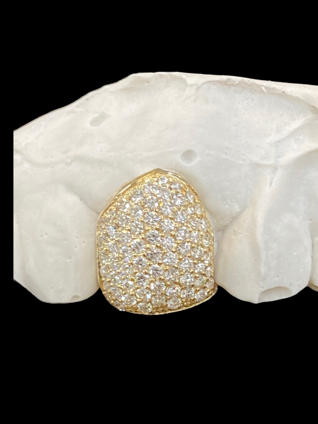 Diamond Grillz 1pc - Etsy