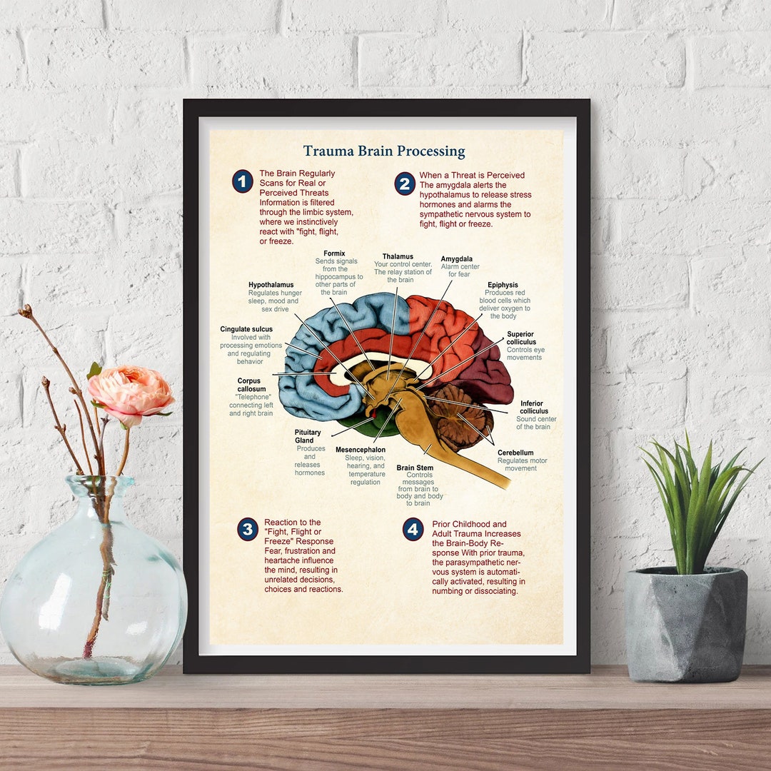 Brain Poster Vintage Anatomy Wall Art Framed Medical Prints Trauma ...