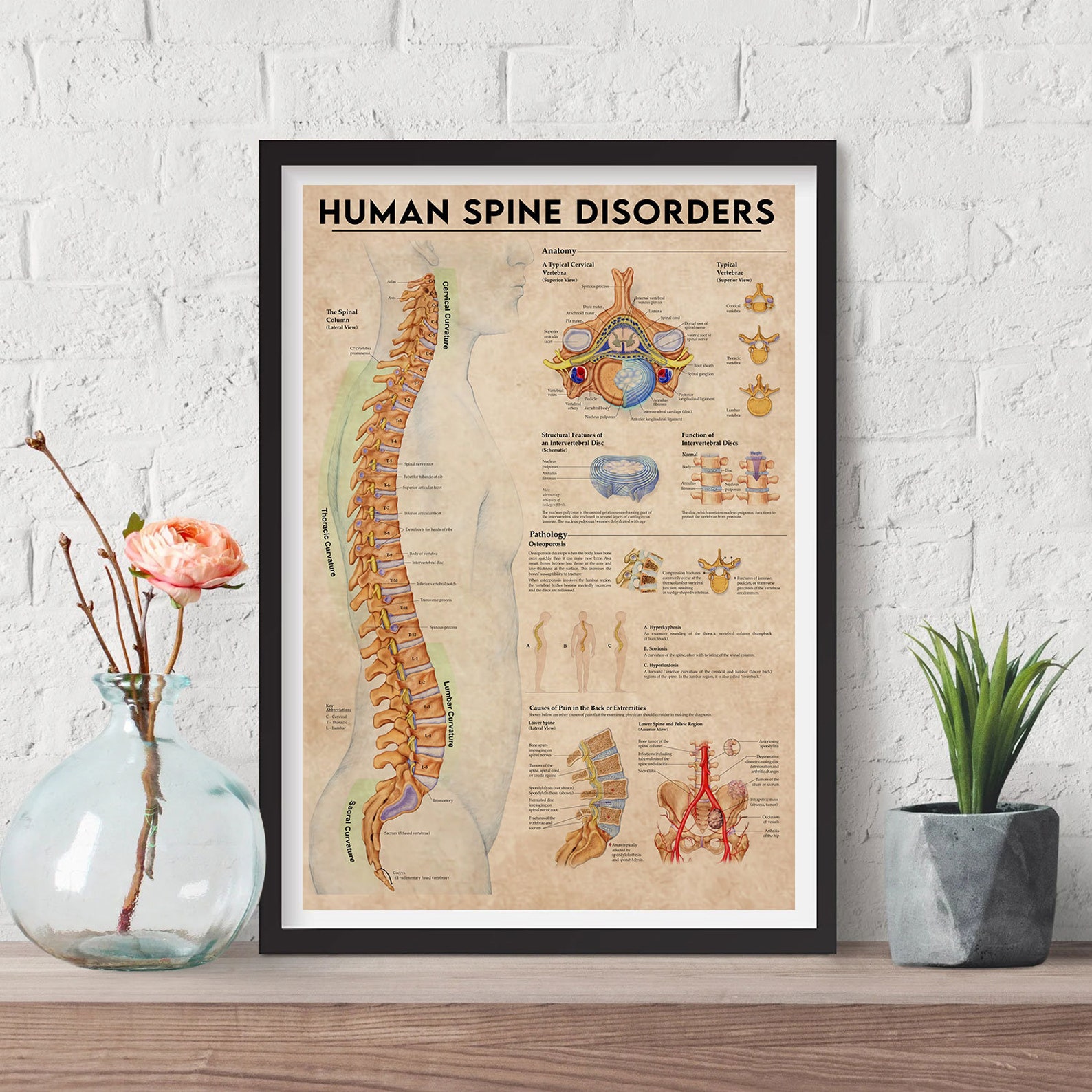 Human Spine Disorders Poster, Sticker Spine Knowledge Doctor Office ...