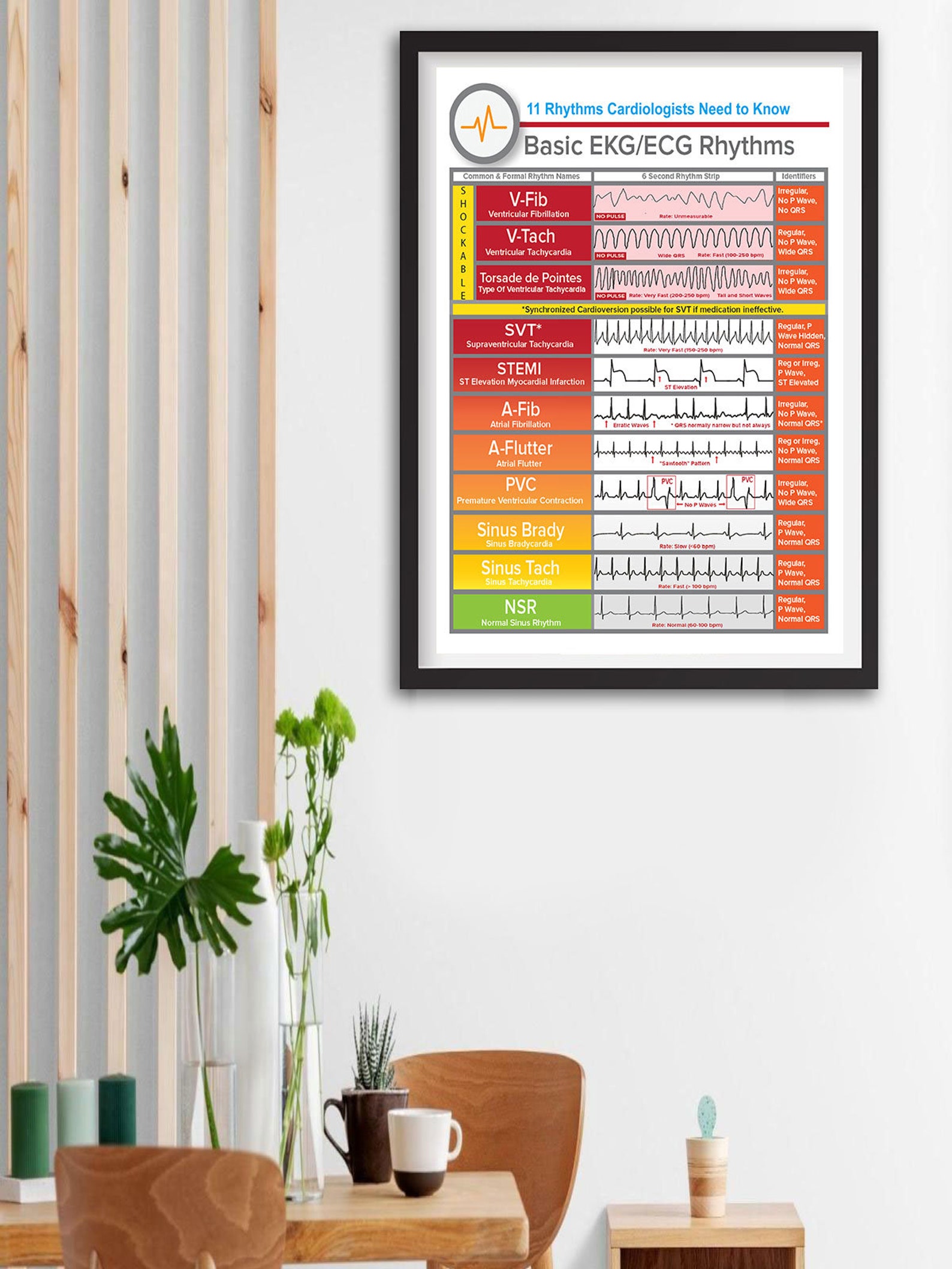 Cardiologist Basic EKG ECG Rhythms Poster Cardiologist Poster Decor ... Cardiologist Basic EKG ECG Rhythms Poster Cardiologist Poster Decor ...
