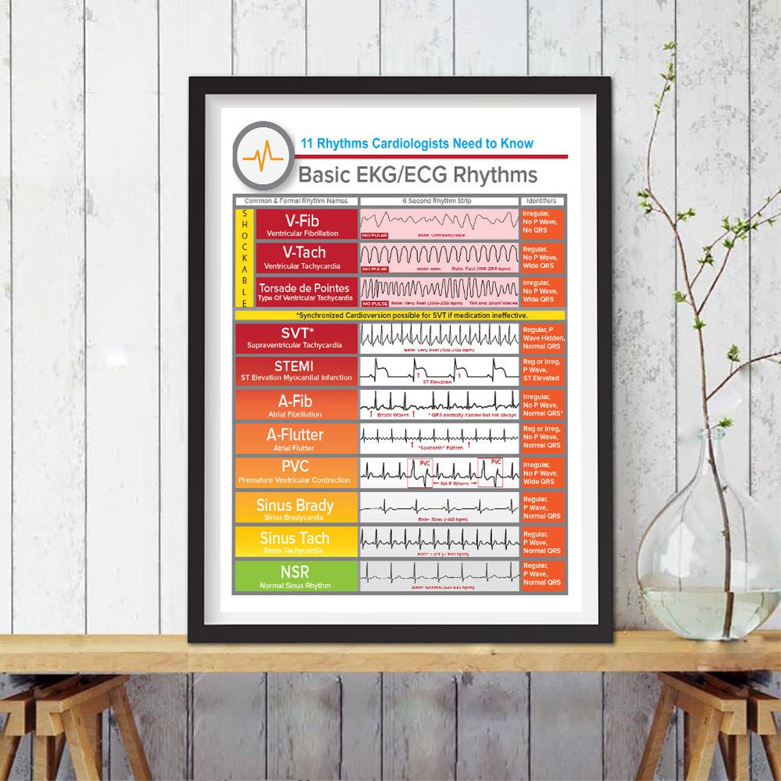 Cardiologist Basic EKG ECG Rhythms Poster Cardiologist Poster Decor ...