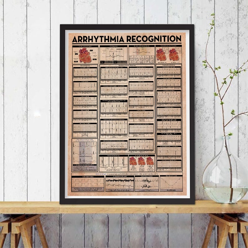 Arrhythmia Recognition Poster Heart Disease Print Cardiologist Office