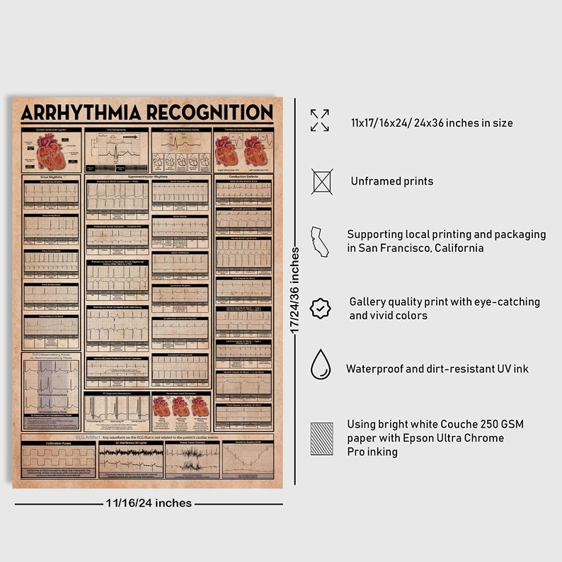 Arrhythmia Recognition Poster Heart Disease Print Cardiologist Office