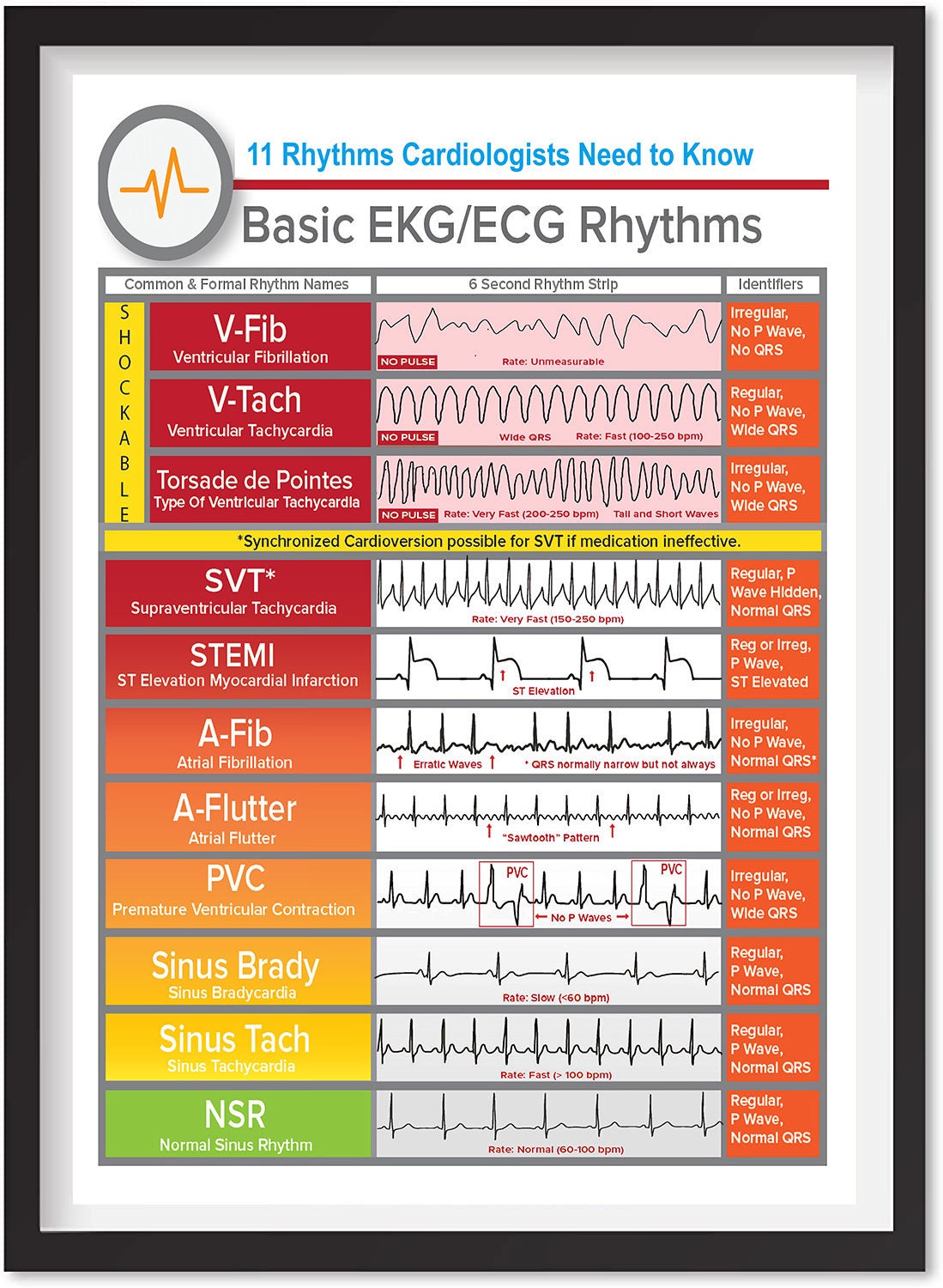Cardiologist Basic EKG ECG Rhythms Poster Cardiologist Poster Decor ... Cardiologist Basic EKG ECG Rhythms Poster Cardiologist Poster Decor ...