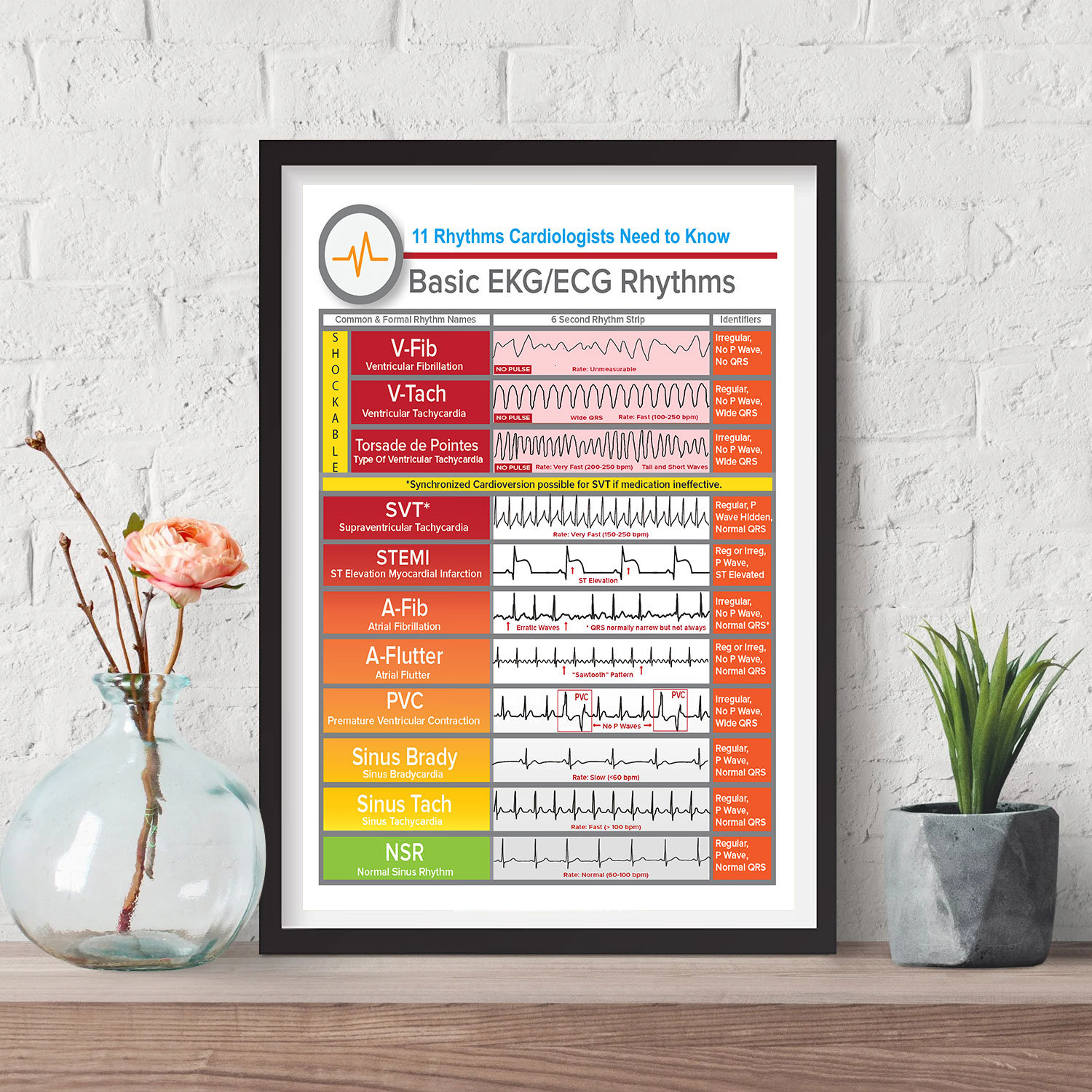 Cardiologist Basic EKG ECG Rhythms Poster Cardiologist Poster Decor ...