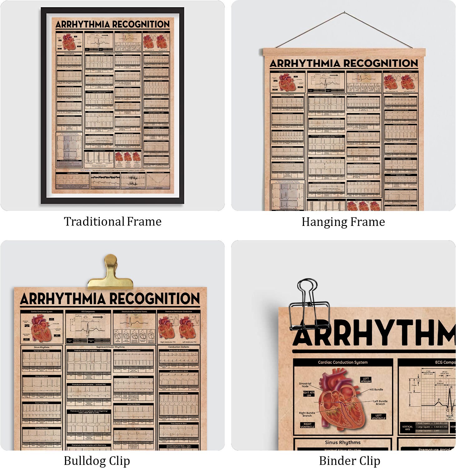 Arrhythmia Recognition Poster Heart Disease Print Cardiologist Office Science Plaques Home Room