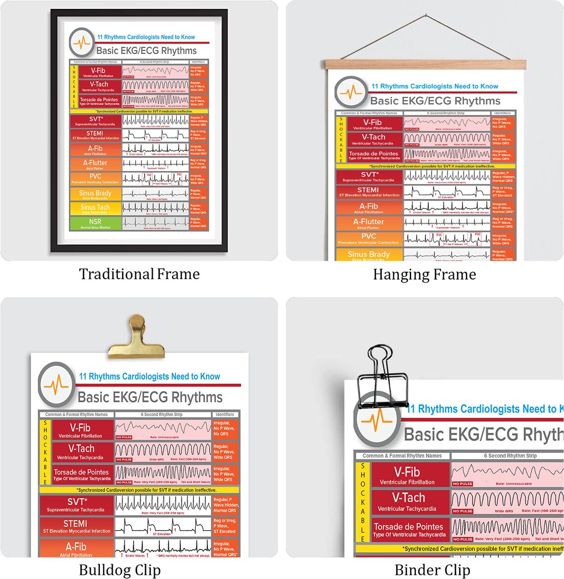Cardiologist Basic EKG ECG Rhythms Poster Cardiologist Poster Decor ... Cardiologist Basic EKG ECG Rhythms Poster Cardiologist Poster Decor ...