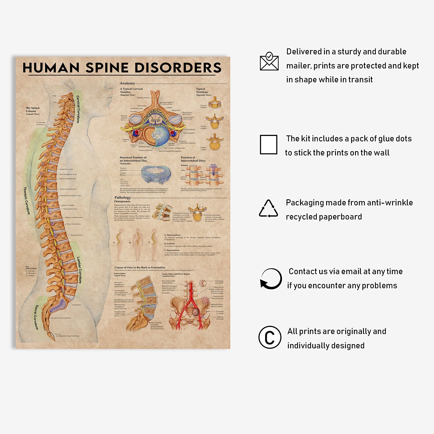 Human Spine Disorders Poster, Sticker Spine Knowledge Doctor Office ...