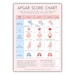 Apgar Score Chart: Newborn Health Assessment Tool (PDF Digital Download ...