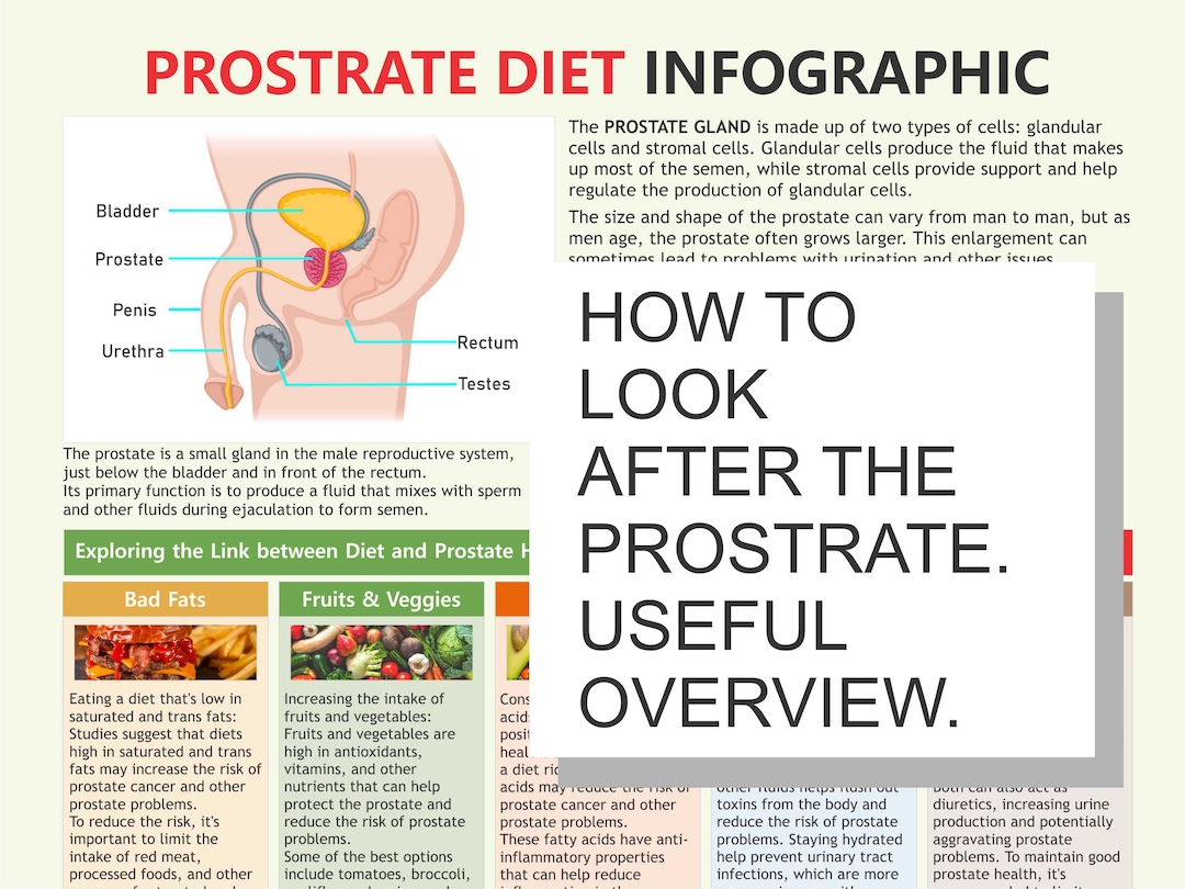 Prostate Infographic Chart, Digital Download PDF, Prostate Chart ...