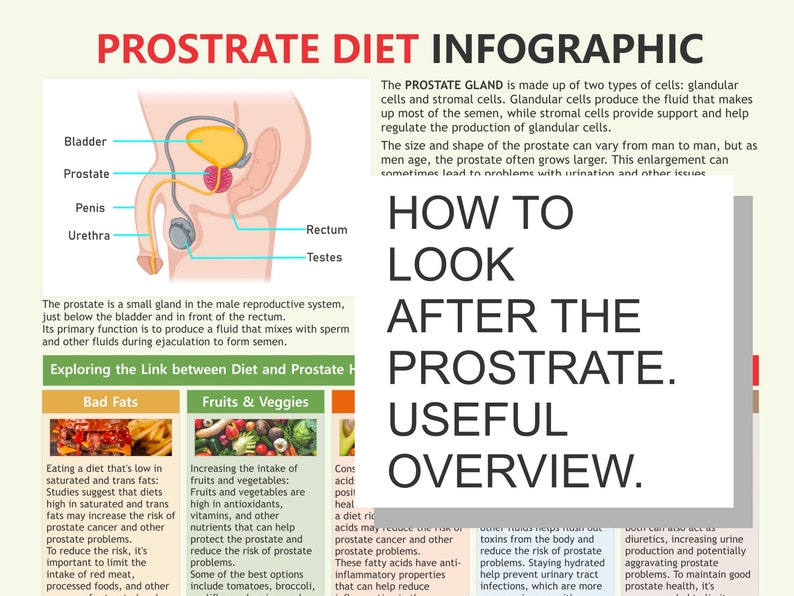 Prostate Infographic Chart Digital Download PDF Prostate - Etsy Australia