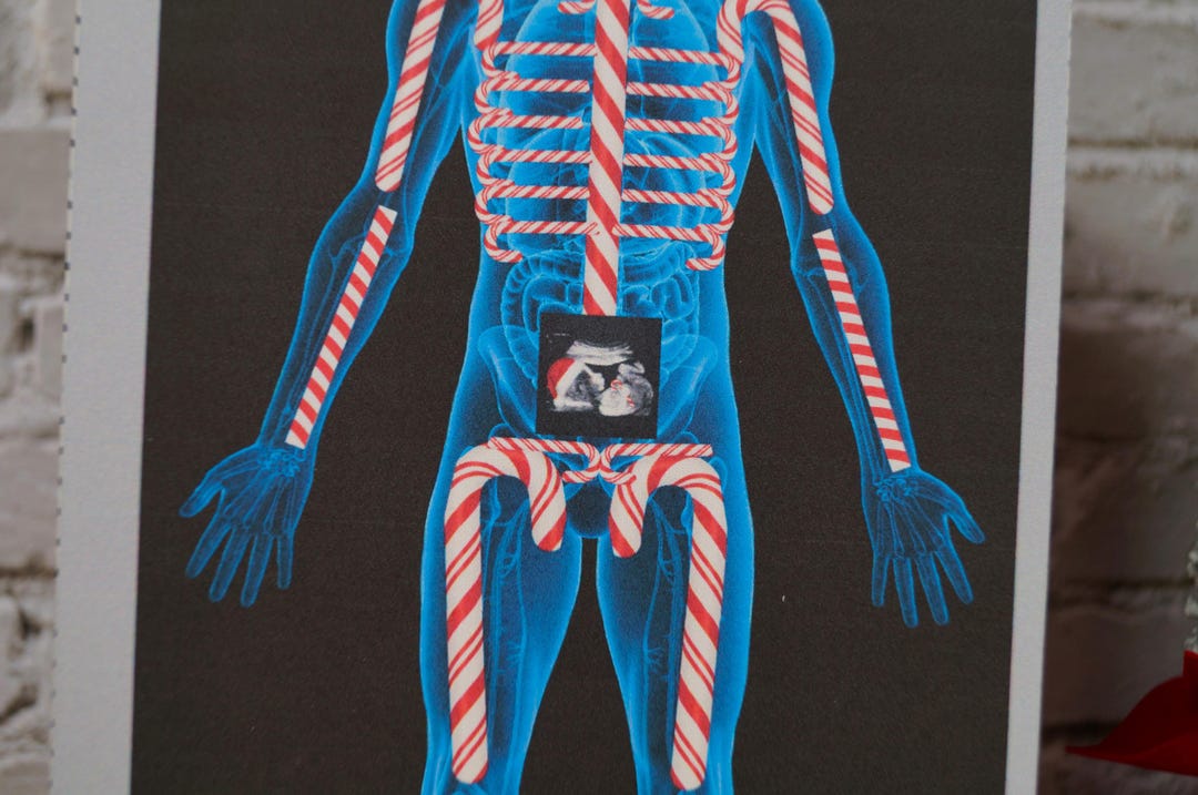 Elf X-ray, X-ray, Pregnant Elf, Baby Elf, Christmas Elf Baby, Elf Props ...