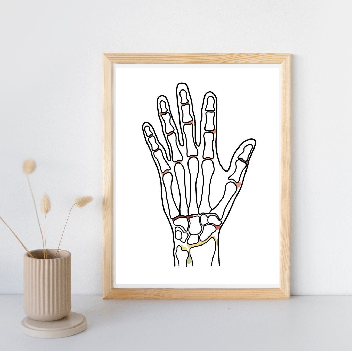 Hand Anatomy Bundle Anatomy & Physiology Notes Bones of the Hand Hand ...