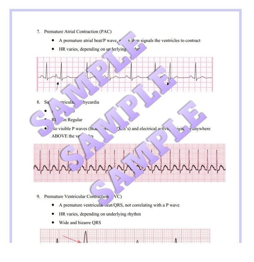 EKG Interpretation Packet: Arrythmias Measurements and More - Etsy