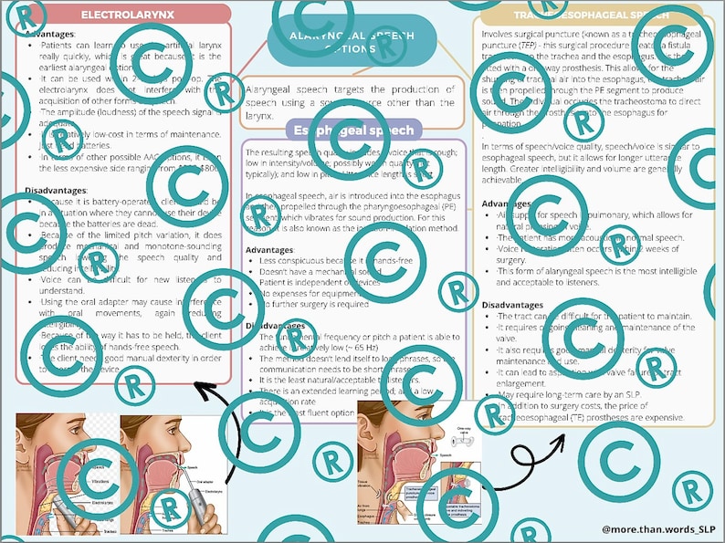 Concept Map: Alaryngeal Speech Options - Etsy