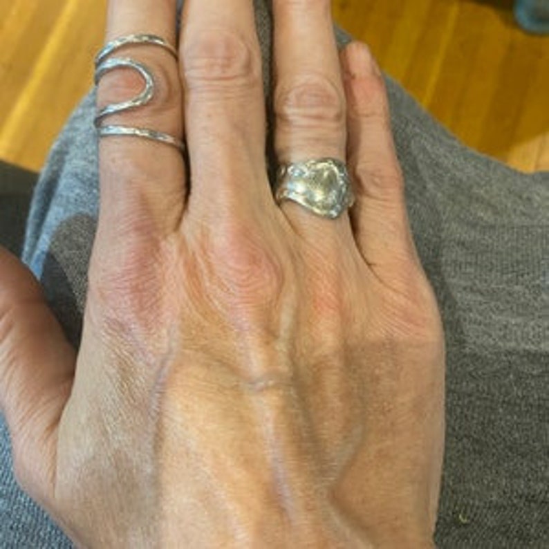 Arthritis Finger Splint Ring,finger Brace Ring,arthritis Relief Ring ...