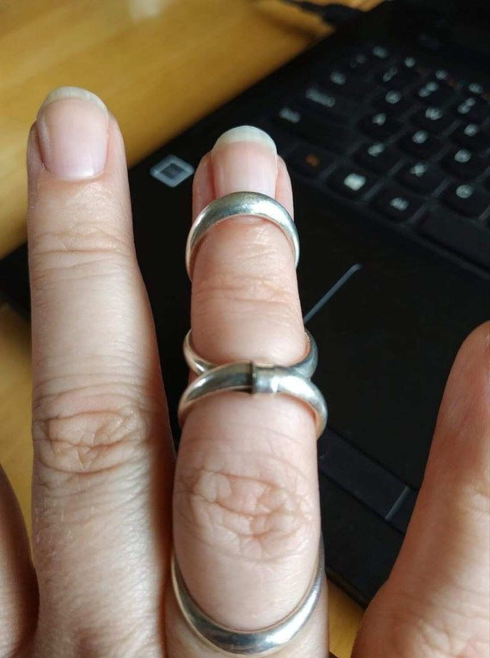 Sterling Silver Arthritis Finger Splint Ring,trigger Finger Splint,full ...