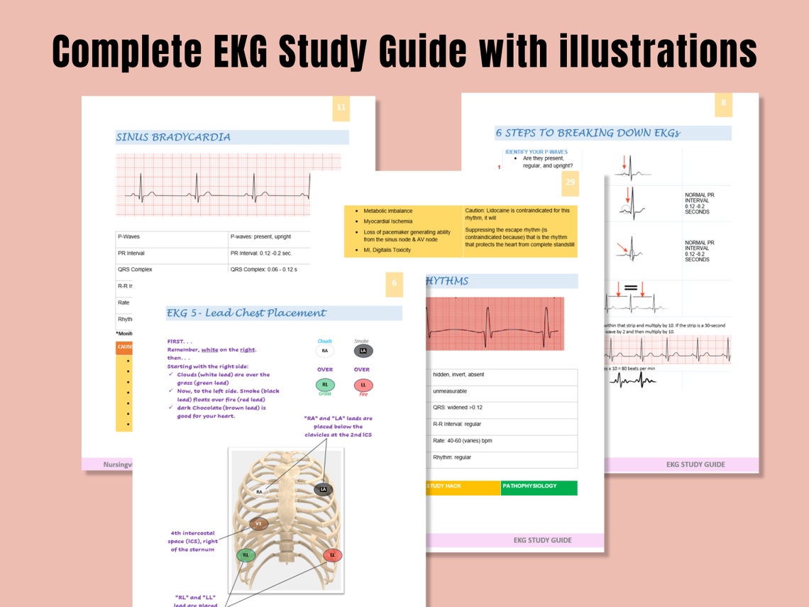 EKG Study Guide, Ekg Interpretations for Nursing Students, Ekg for ...