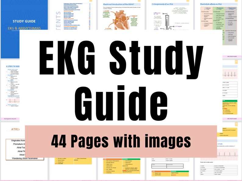 EKG Study Guide: Nursing School EKG Interpretations (44 Pages) - Etsy