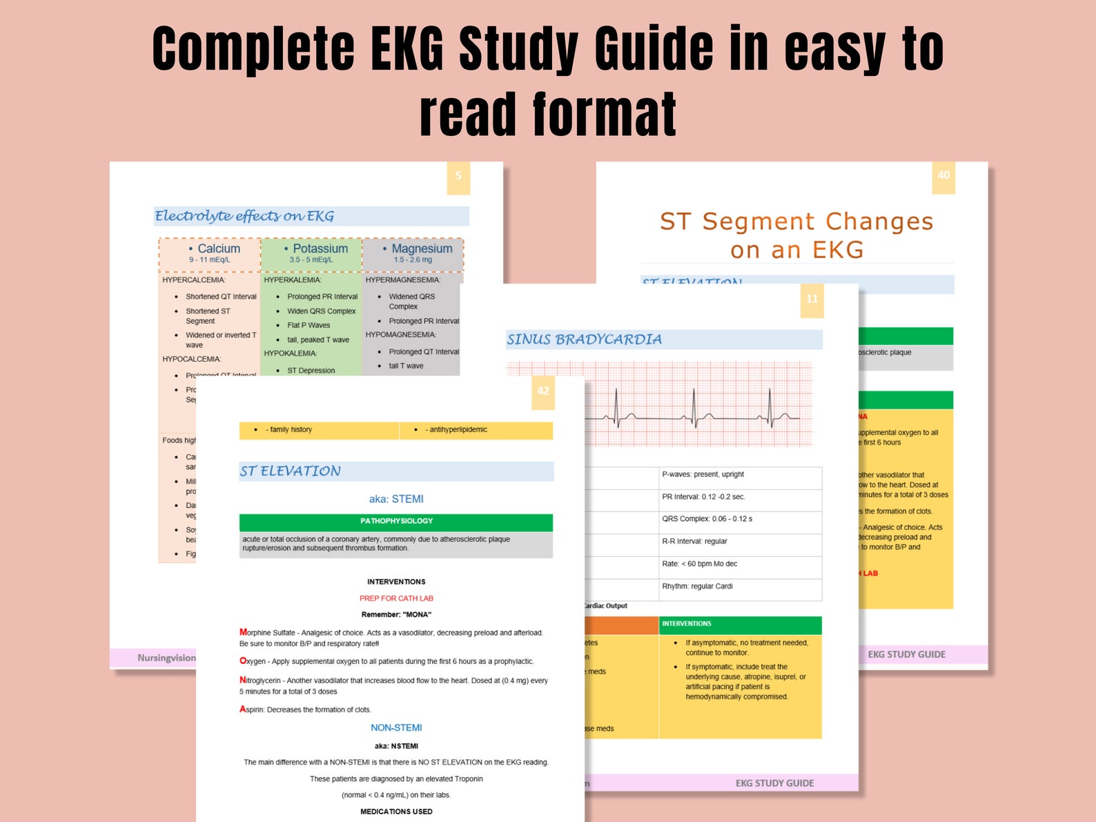 EKG Study Guide: Nursing School EKG Interpretations (44 Pages) - Etsy