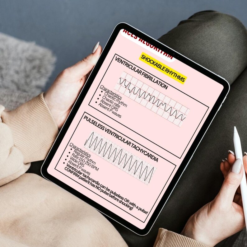 Nursing Cardiac Arrest Notes - Ace Your Sims as a Student Nurse! - Etsy
