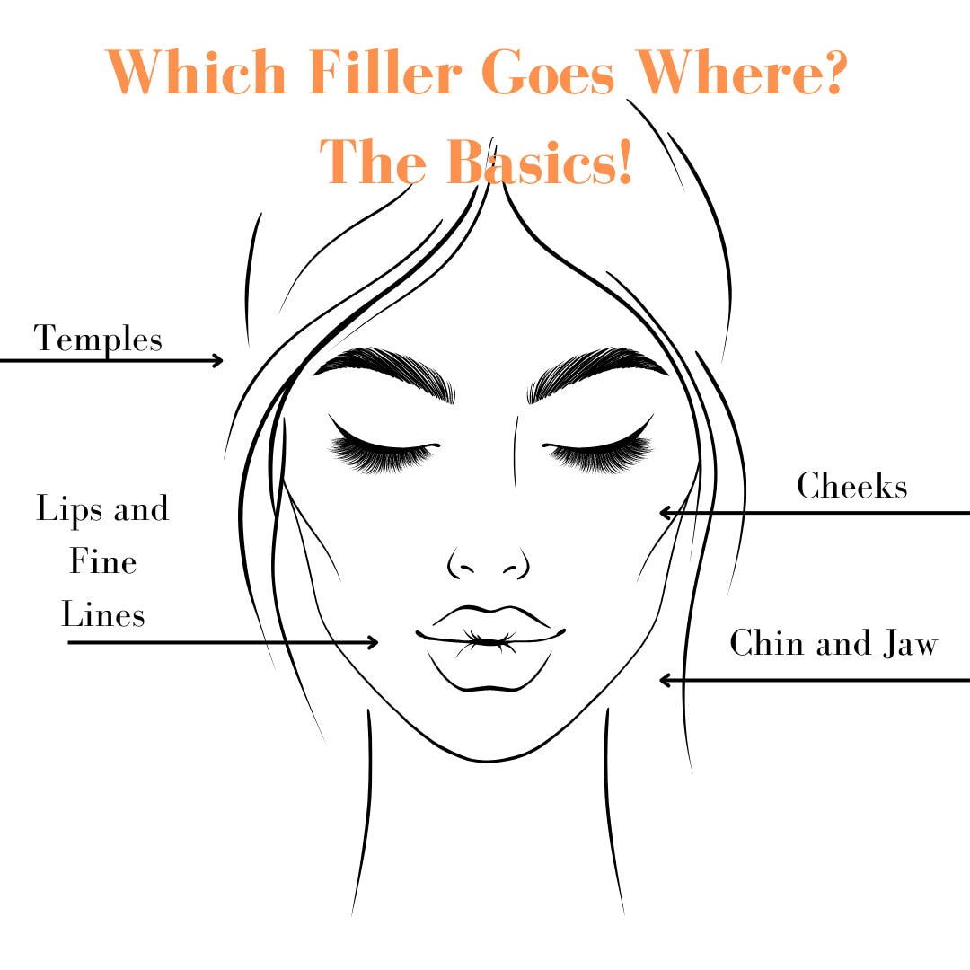 Filler Placement Cheat Sheet, Nurse Injector, Aesthetic Injector, Study ...