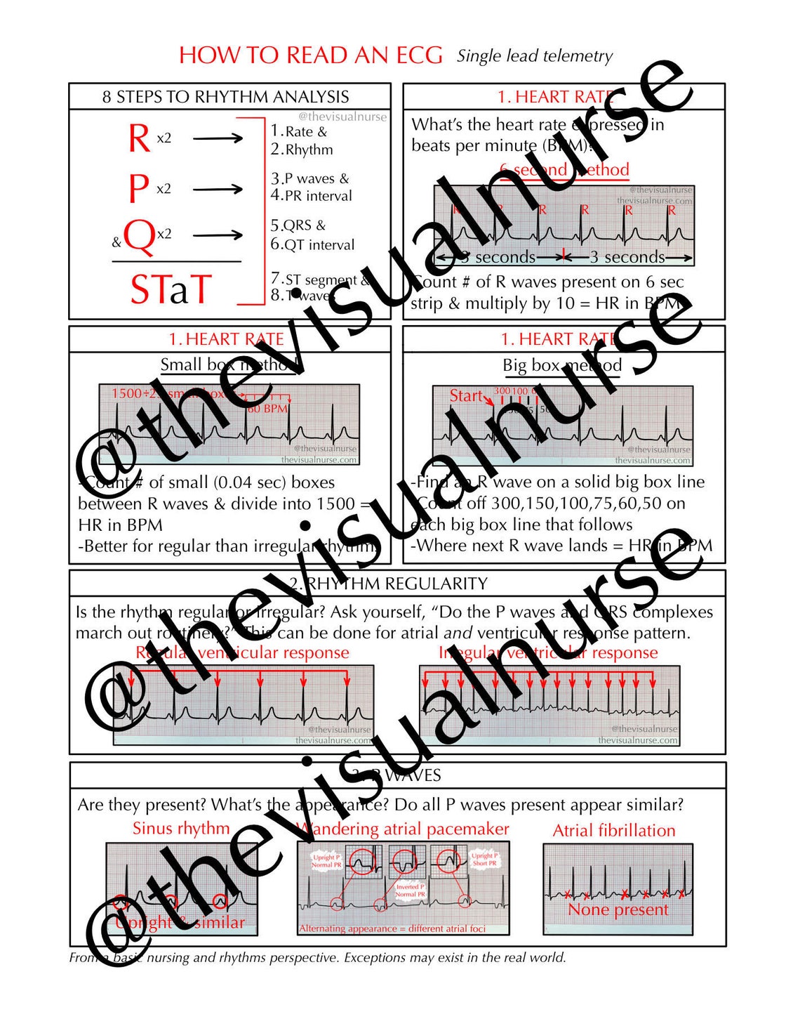 How to Read an ECG Single Lead Telemetry PDF Instant Download - Etsy