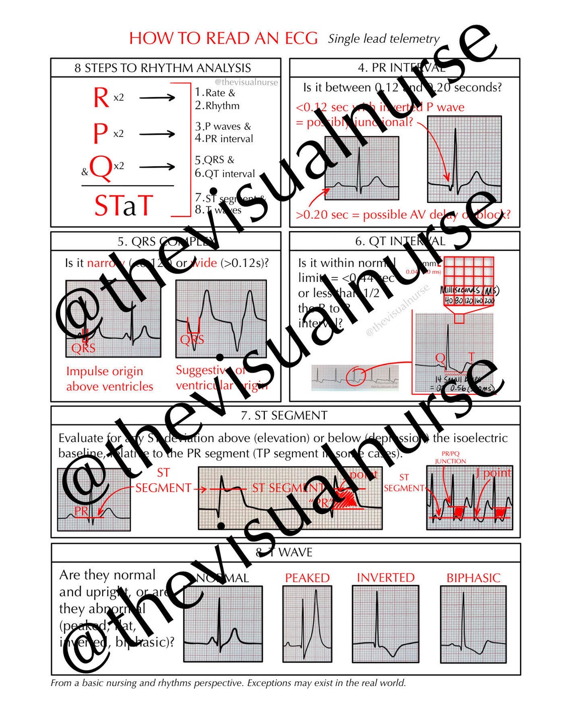 How to Read an ECG Single Lead Telemetry PDF Instant Download - Etsy